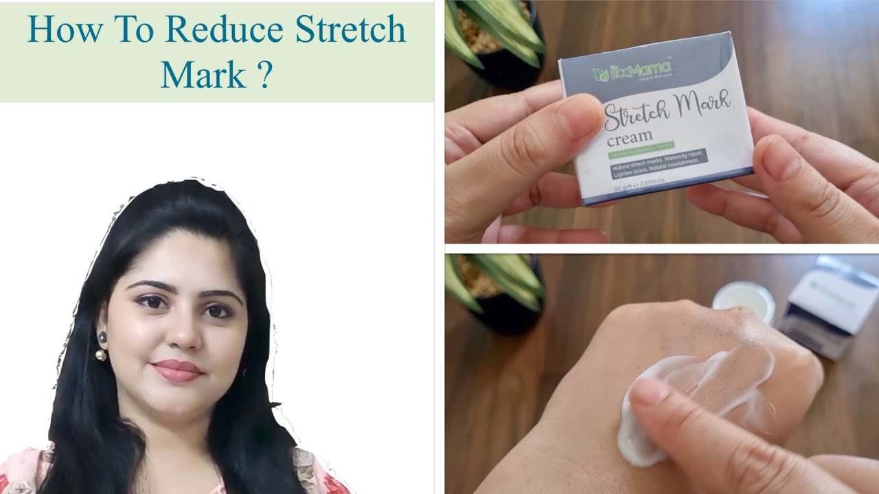 How To Reduce Stretch Mark? | The ECO Mama Stretch Mark Cream review ...