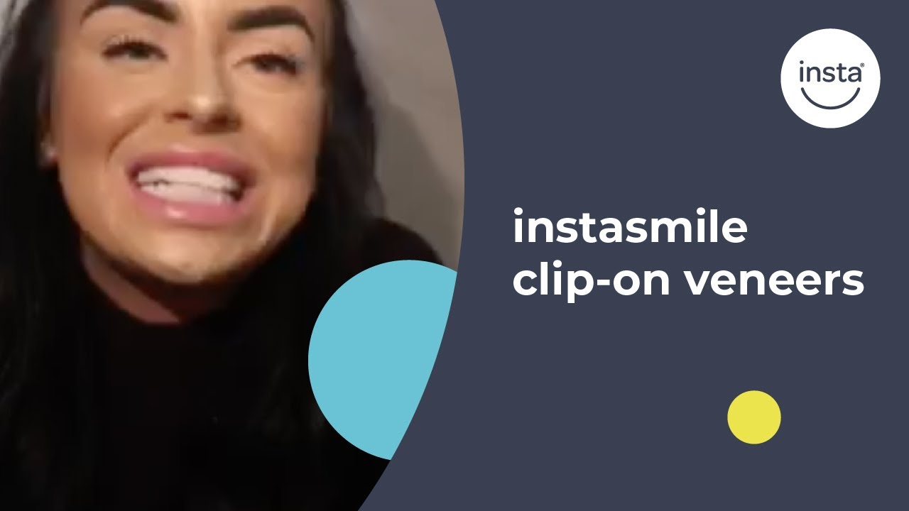 Clip-On Veneers Full Process Review | Instasmile - YouTube