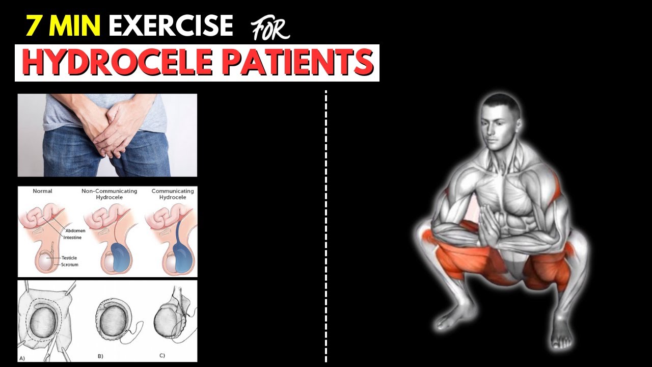 Simple Yoga And Exercise For Hydrocele Problem Youtube