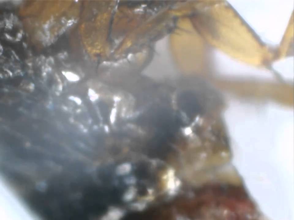 400x Magnification of a barely living flea. Nasty! - YouTube