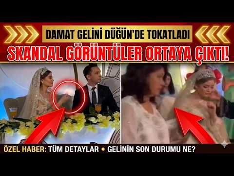 Damat Gelini Düğün'de Tokatladı