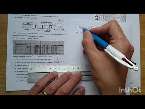 exercice trame UART Sti2d