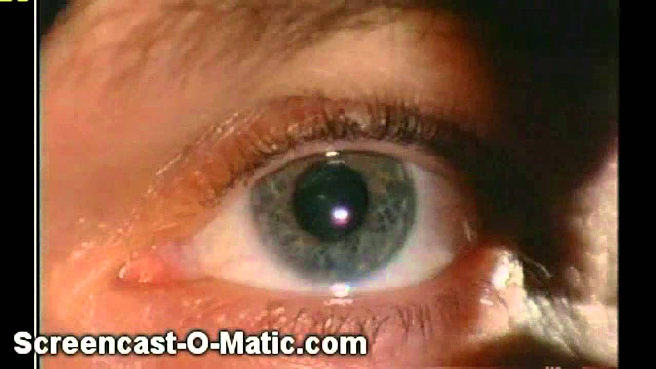 Blindsight - Seeing Without Awareness - YouTube