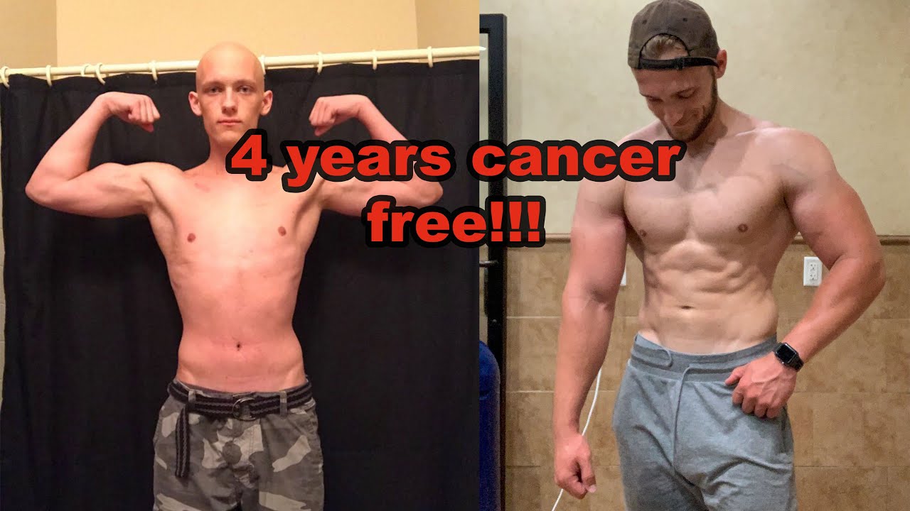 4 years cancer free update!!! - YouTube