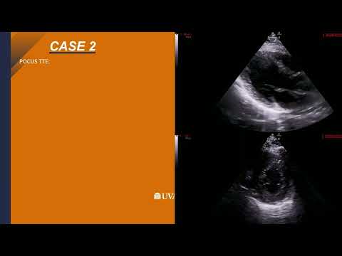 SAEM23: 2023 E/M Changes and How They Impact POCUS