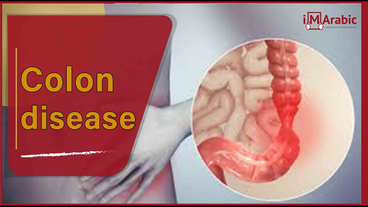 Seven natural recipes to treat colon and bloating - YouTube