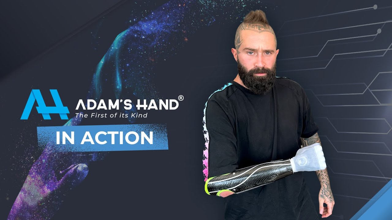 Riccardo using Adam’s Hand - YouTube