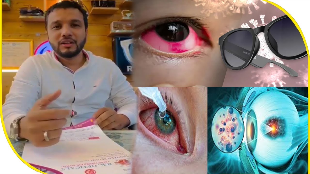Eye Flu: Md Zubair, RK Optical on Eye Infection | BBN NEWS - YouTube