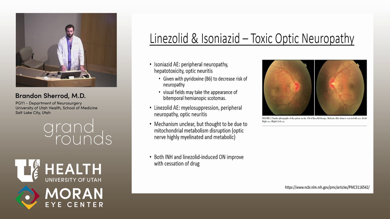 Ophthalmology Grand Rounds 2019- Part 1 of 3 - YouTube