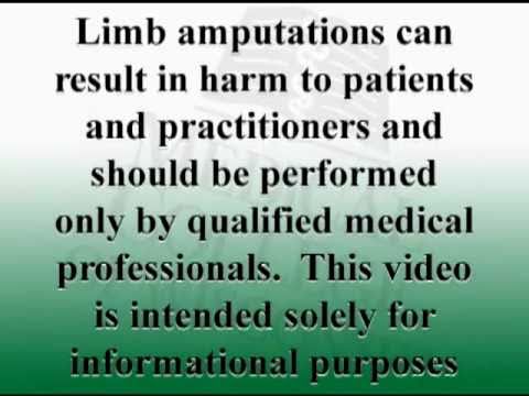 Field Lower Extremity Amputation - YouTube