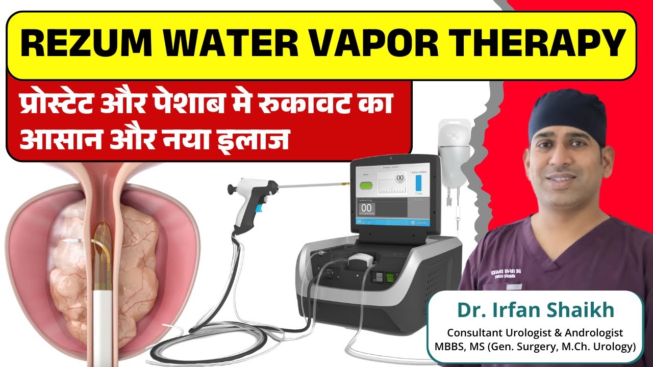 Rezum Water Vapor Therapy For Enlarged Prostate in Hindi | Dr. Irfan ...