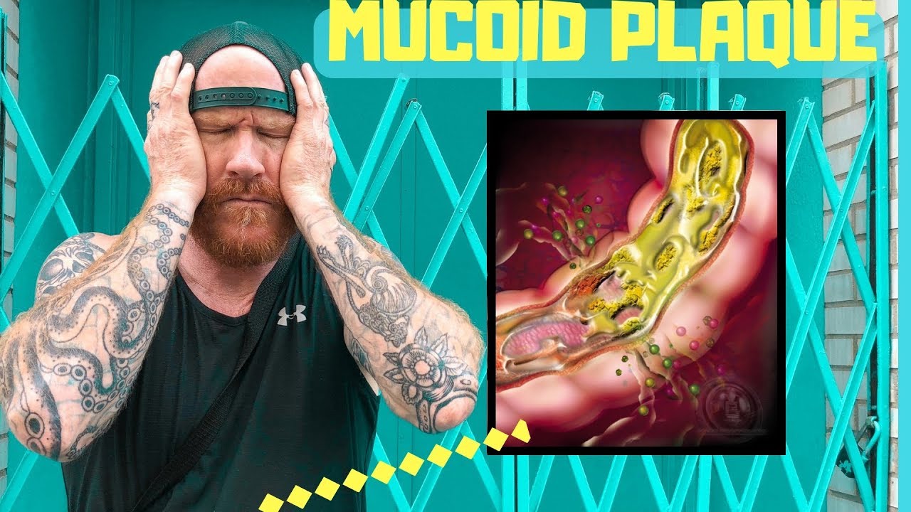3 Best Ways To Remove Mucoid Plaque - YouTube
