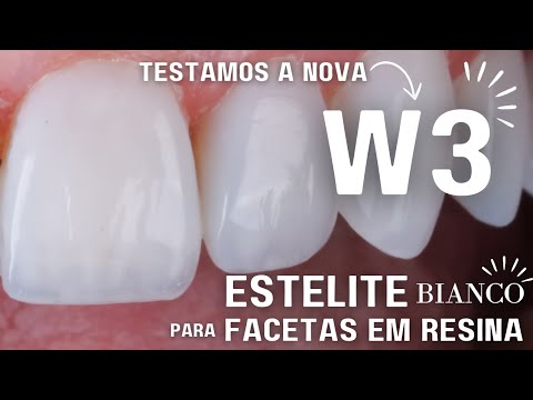 💎TESTEI A NOVA ESTELITE BIANCO! Teste em Modelo + 2 CASOS com ela🤩 ...