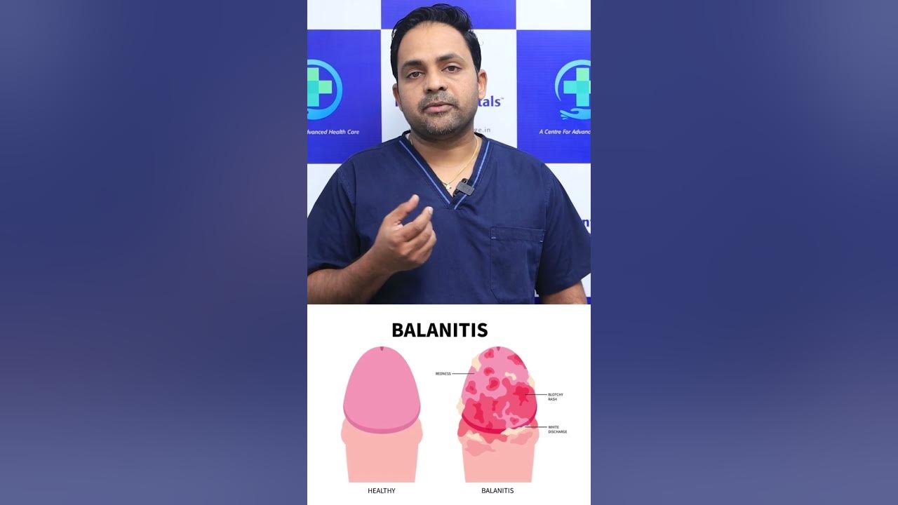Difference Between Balanitis and Balanoposthitis Telugu || #shorts #ytshorts #trending # ...