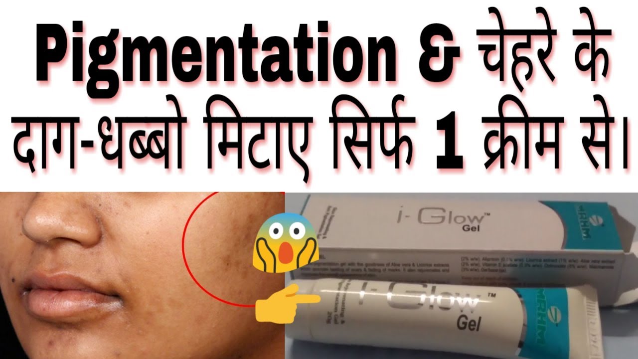 i-Glow Cream Full Review | Remove Pigmentation , Dark Spots ...