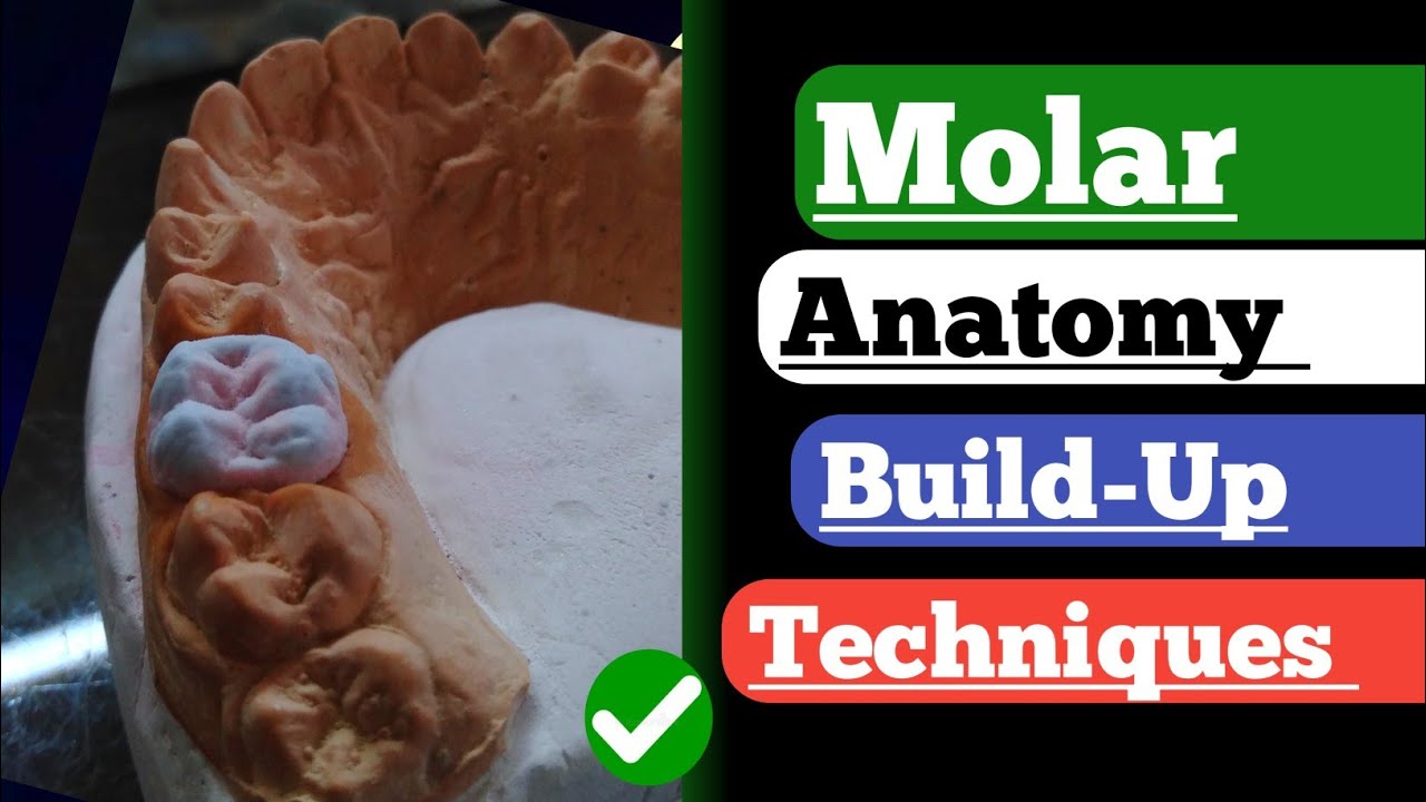 Molar Anatomy Build up Techniques|| Ceramic porcelain Technique| How to ...