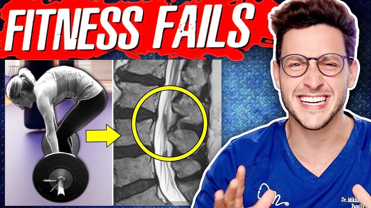 Worst Fitness Mistakes My Patients Make - YouTube