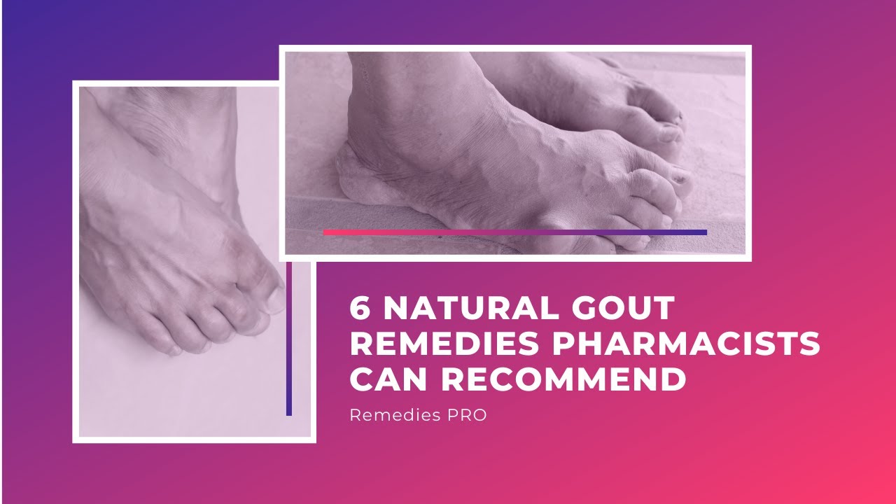 6 Natural Gout Remedies Pharmacists Can Recommend - YouTube