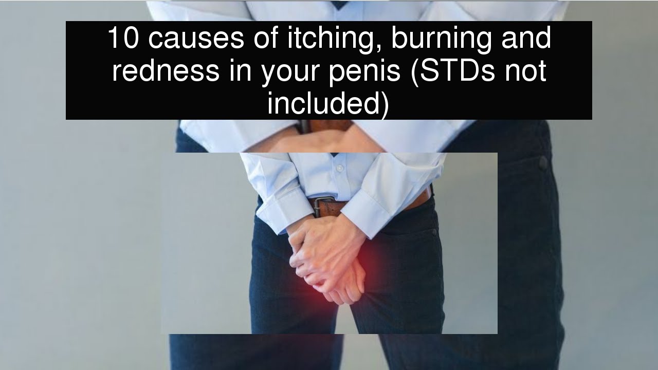 10 Causes Of Itching Burning And Redness In Your Penis STDs Not