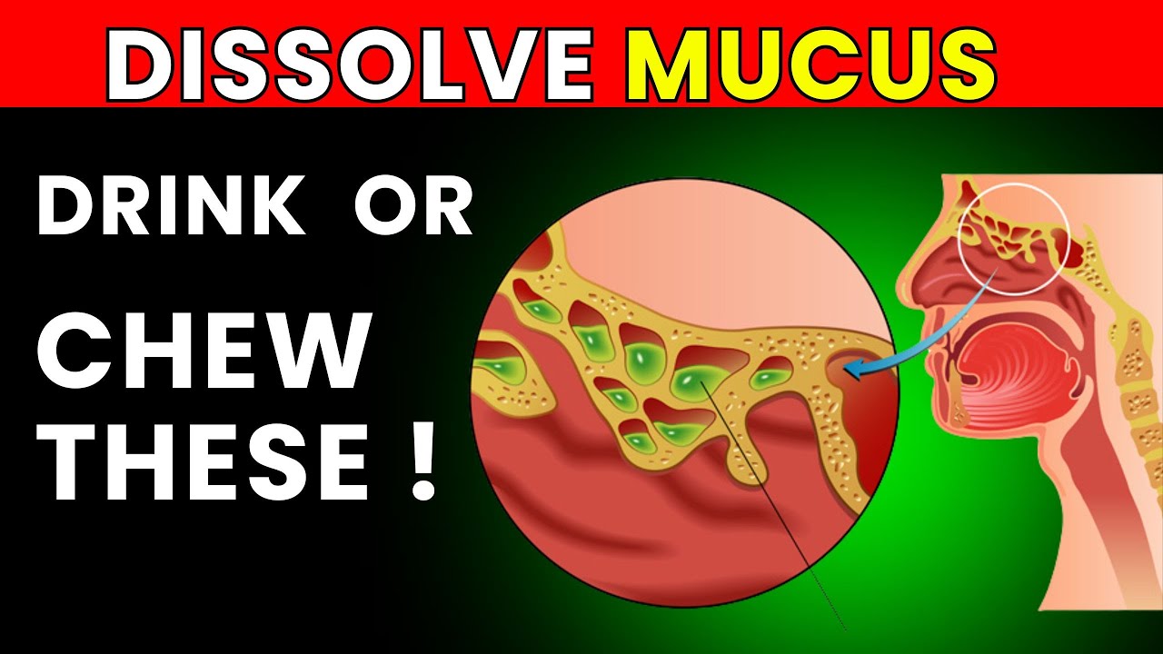 Natural Remedies to Dissolve Mucus in Sinuses, Chest & Lungs ...
