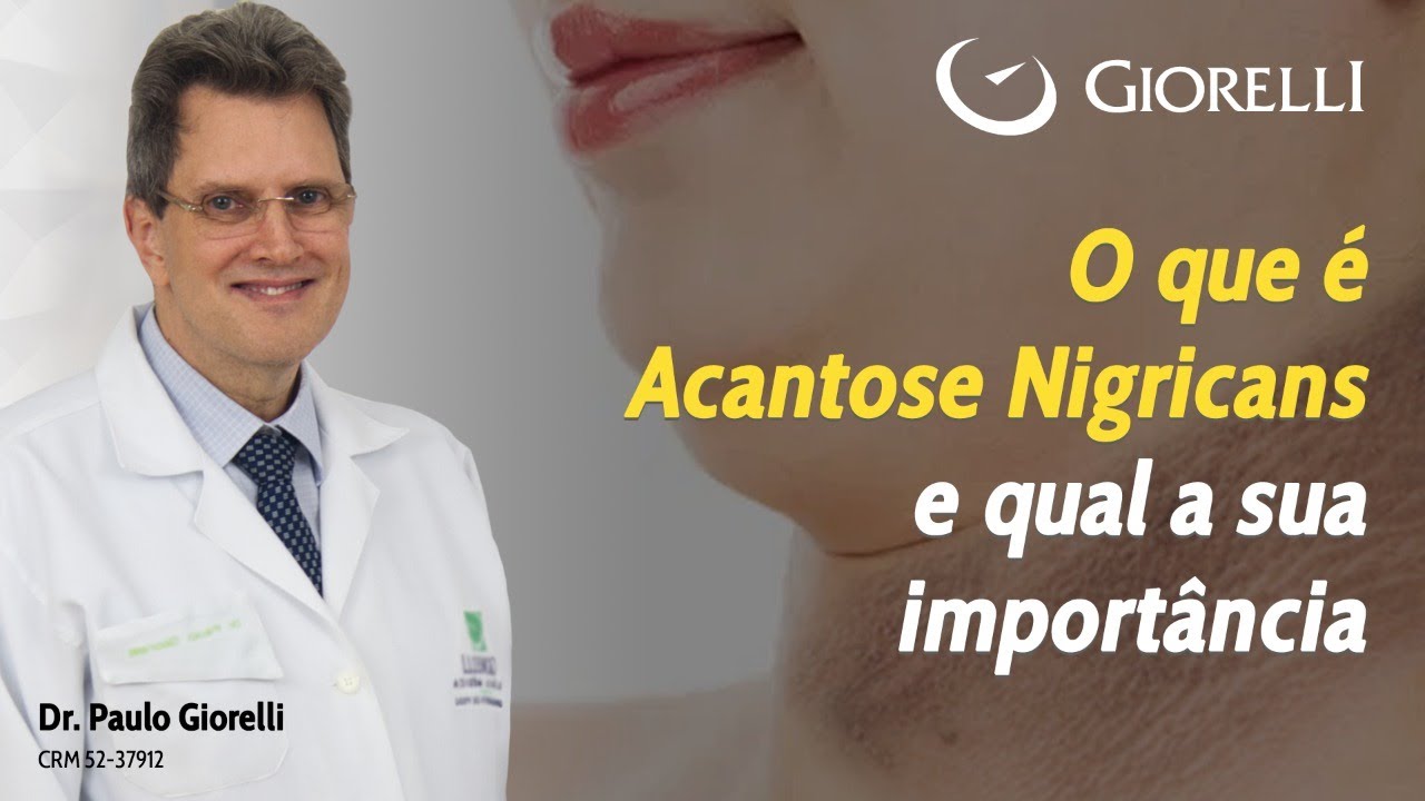 O que é Acantose Nigricans e qual a sua importância - YouTube