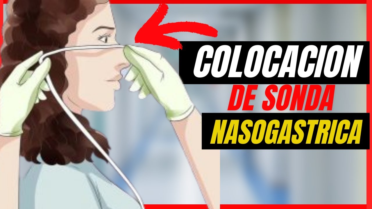 👉😱Colocacion de SONDA NASOGASTRICA cuidados de enfermeria PEDIATRICOS Y ...