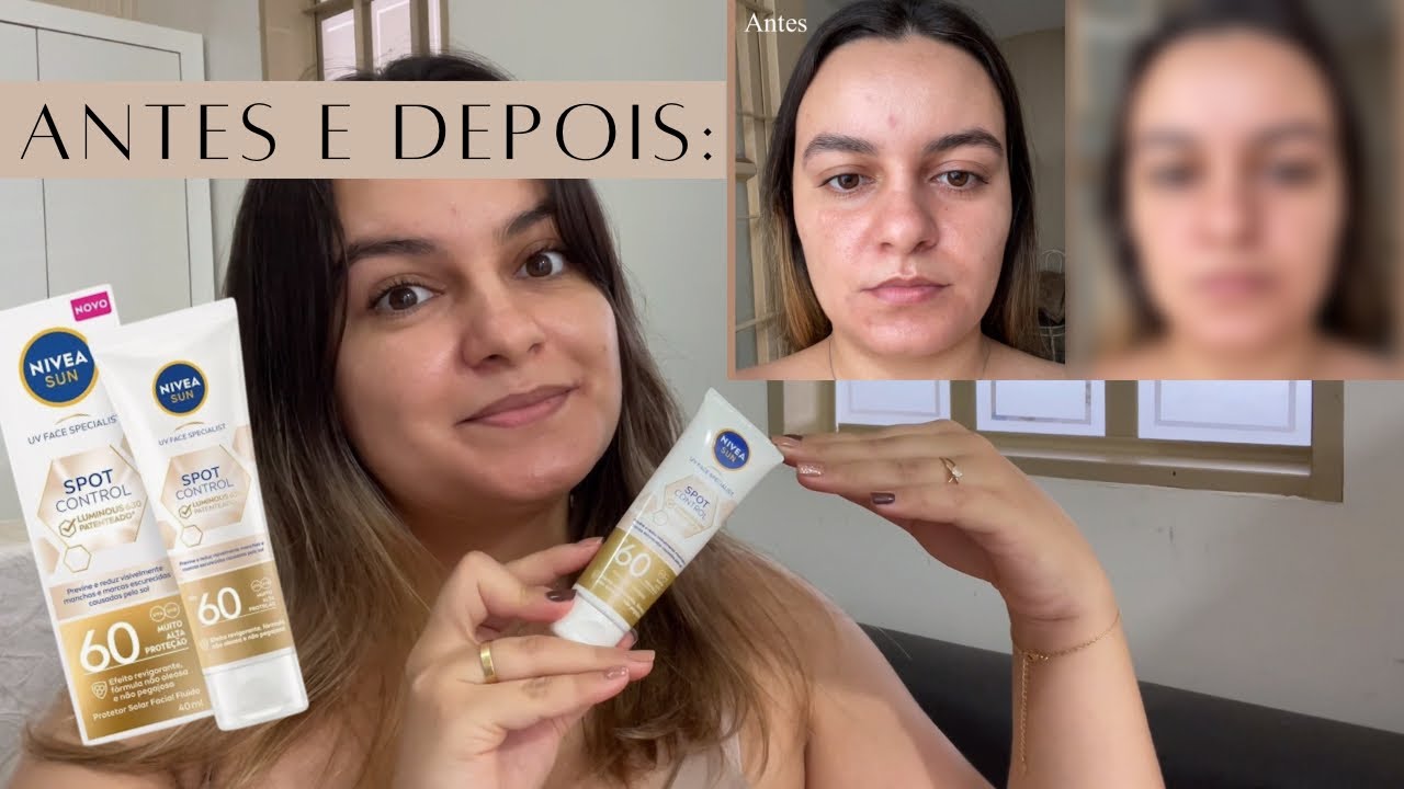 Resultado do antes e depois do protetor solar nívea clareador, o ...