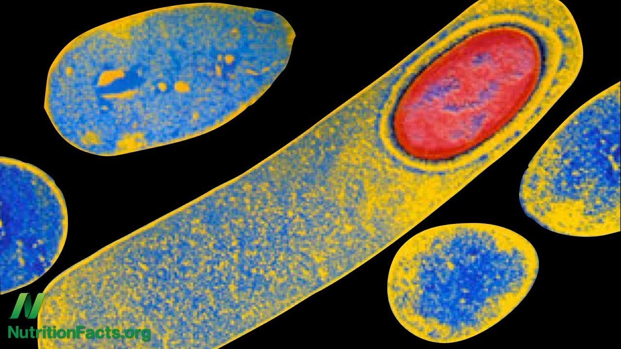 Toxické megakolon a superbakterie - YouTube