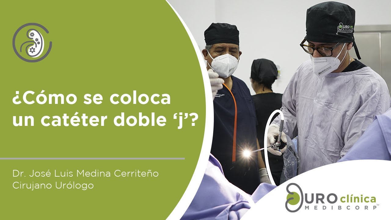 COMO SE COLOCA UN CATETER DOBLE J - YouTube