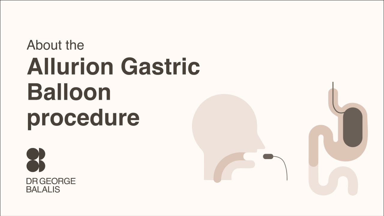 Dr George Balalis | About the Allurion Gastric Balloon procedure - YouTube