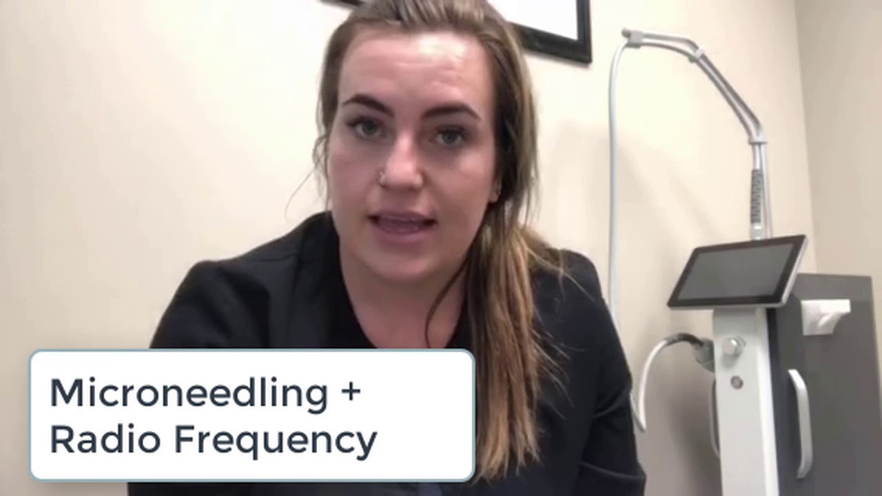 What is Secret RF for Skin Remodeling? - YouTube