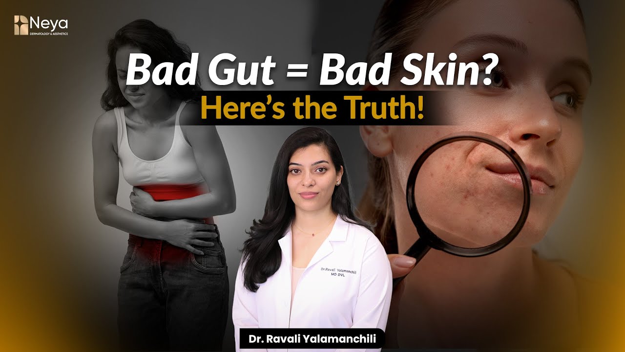 Skin issues and gut health | Acne due to poor gut health #skinproblems ...