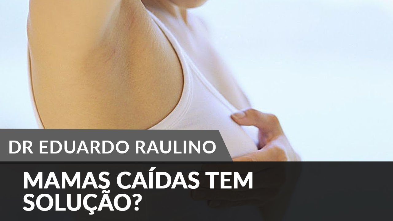 Mamas Caídas Tem Solução Youtube