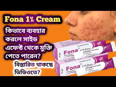 Fona 0.1%Cream Full Review Bangla ব্রণের জন্য কিভাবে ব্যবহার করলে সাইড ...