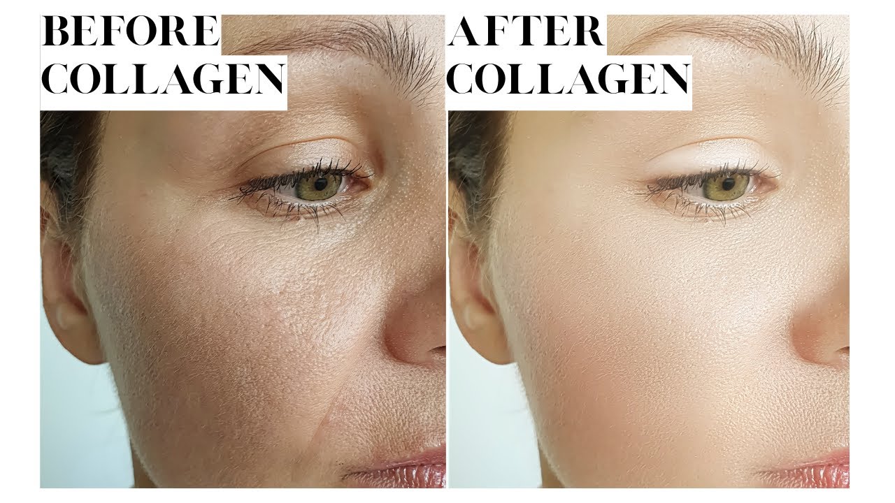 4 Simple Ways to Boost Collagen Naturally (FAST Results!) - YouTube