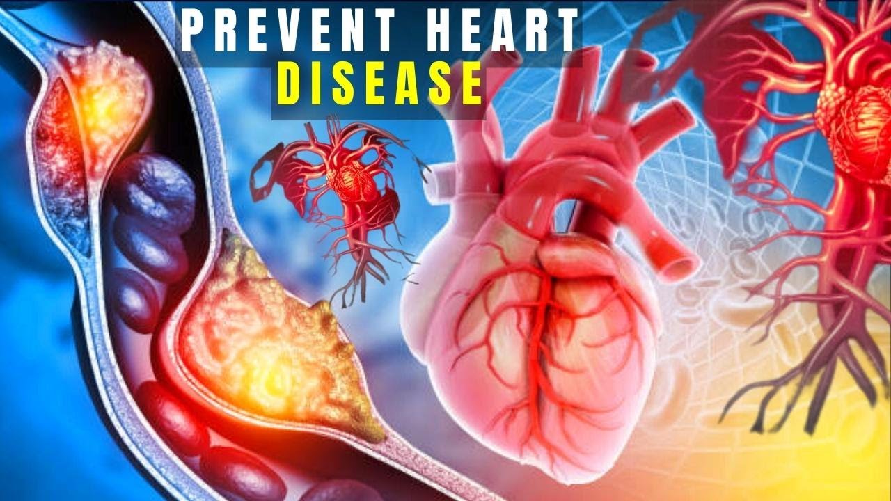 Prevent heart disease and stroke! heart block disease - how to protect ...