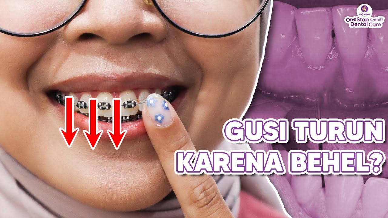 MITOS ATAU FAKTA?!! BEHEL BIKIN GUSI TURUN? - YouTube