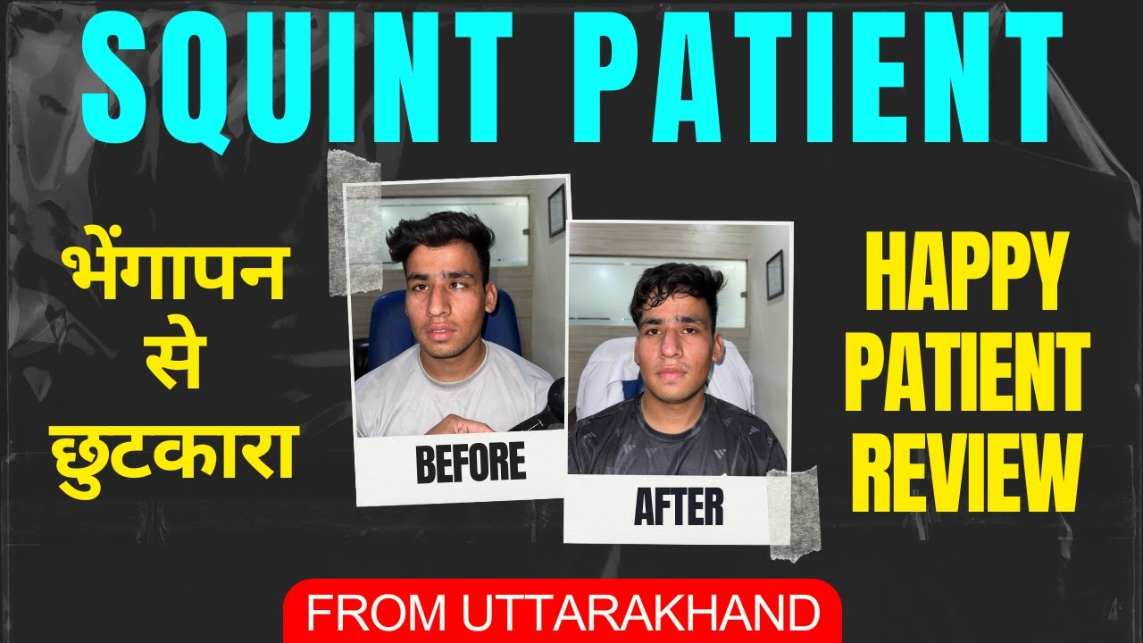 Strabismus Surgery Or Squint Surgery Treatment Or Crossed Eyes Happy ...