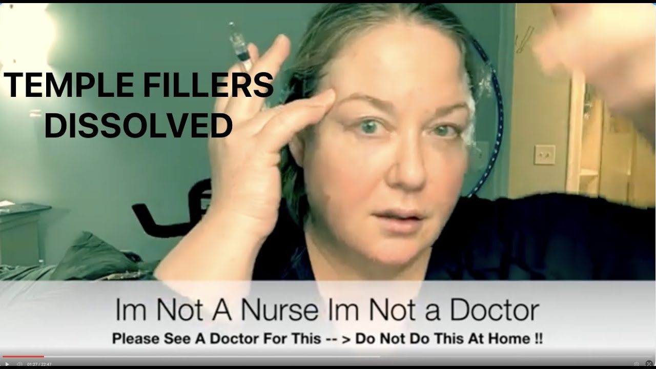 I REMOVED TEMPLES & BULK - FAT WITH FILLER DISSOLVER DIY= TEMPLES I ...