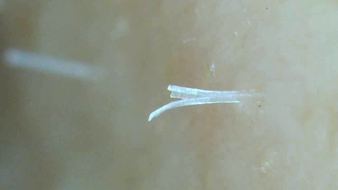 Beard Plucking : Microscope Art File(228) - YouTube