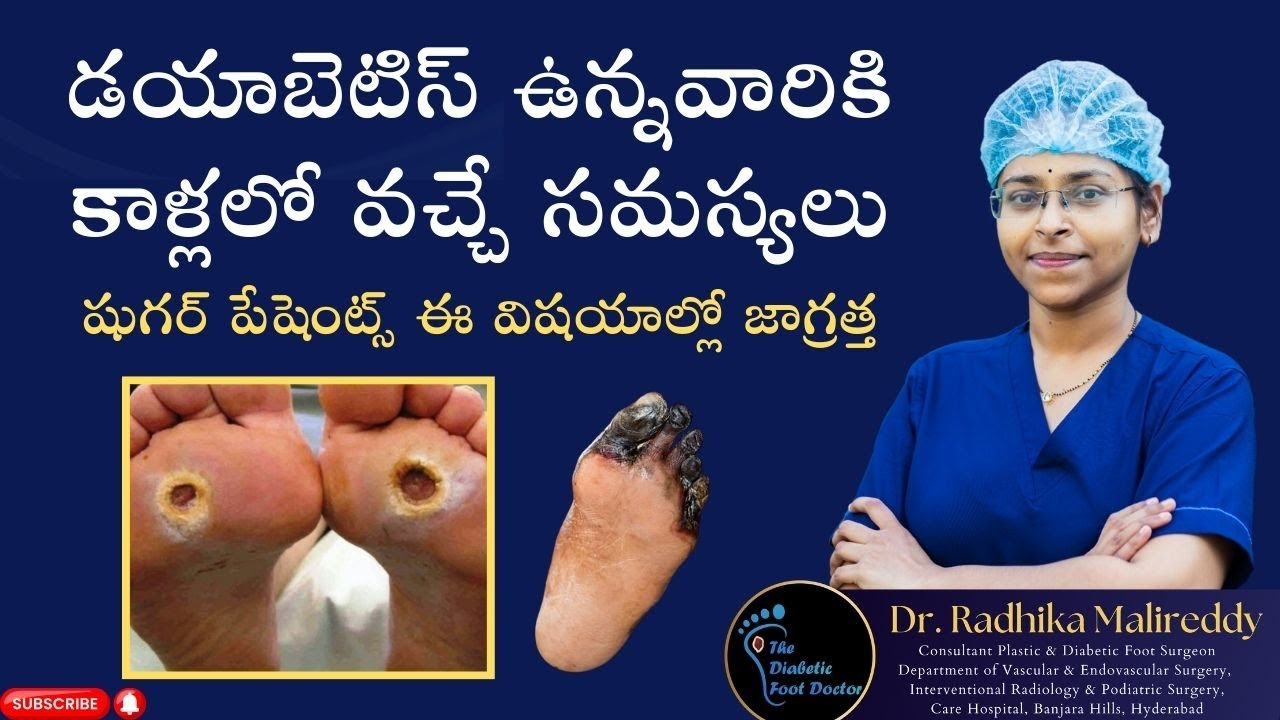 డయాబెటిస్ ఉన్నవారికి కాళ్లలో వచ్చే సమస్యలు | Diabetic Foot Problems ...
