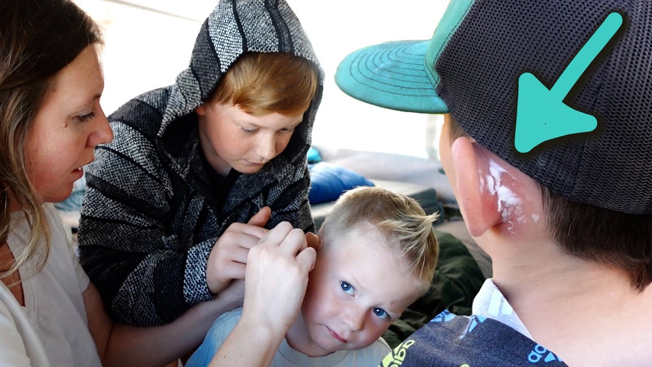 WHAT HAPPEND TO YOUR EAR TOO || So Many Ear Injuries! - YouTube