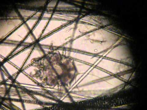 Cheyletiella Mite - YouTube