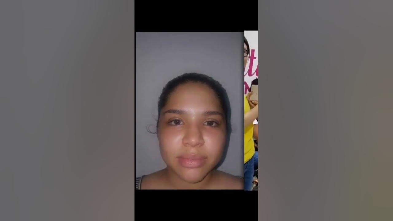 Yeri Mua Antes Y Despues De Sus Cirugias Youtube