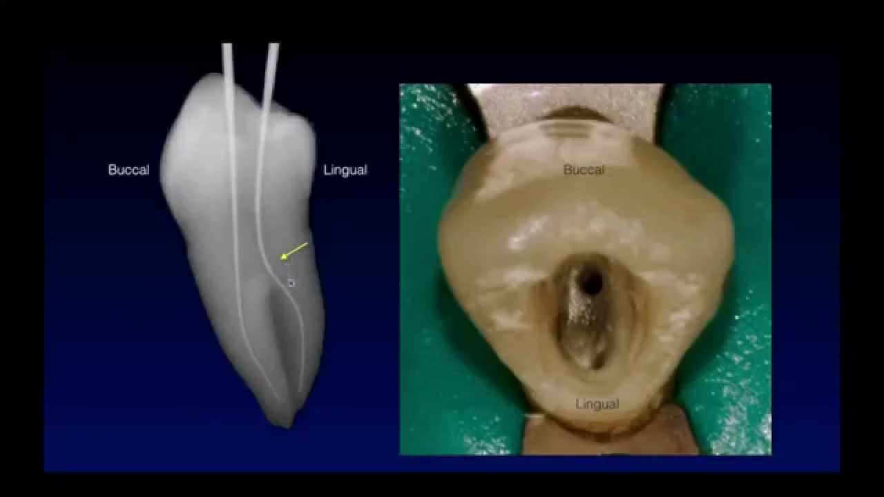 Straight Line Access: Dr. Alex Fleury Podcast - YouTube