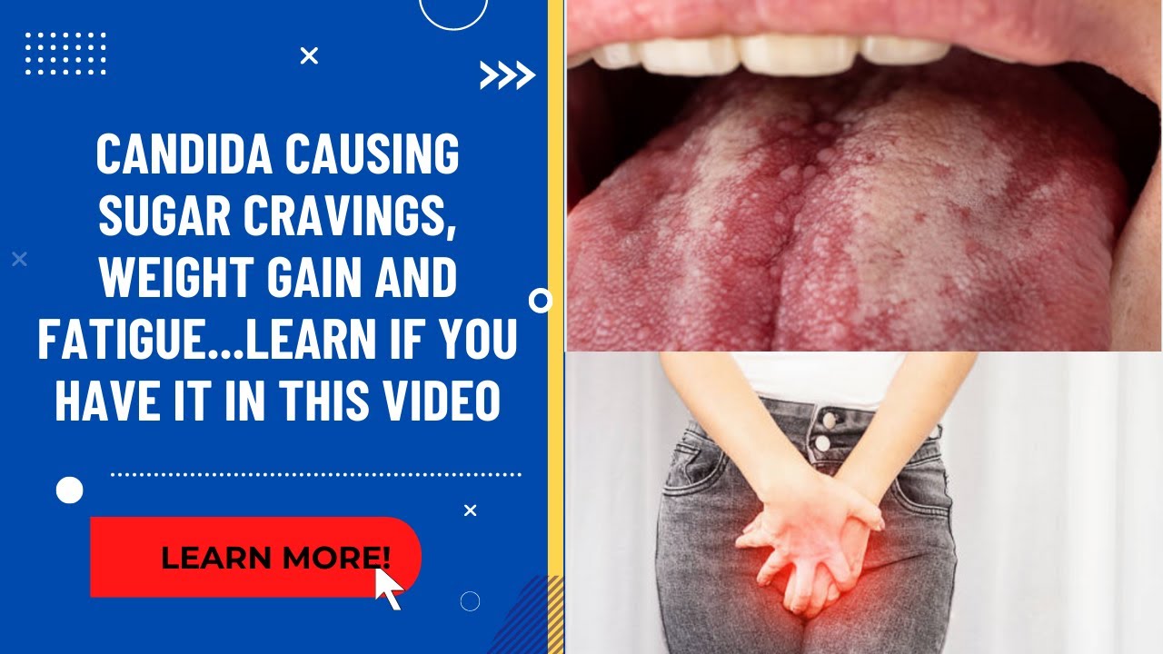 Struggling with sugar cravings, weight gain and fatigue...CHECK FOR ...