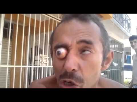 HOMBRE SACA EL OJO PARA AFUERA!!! 2015 - YouTube