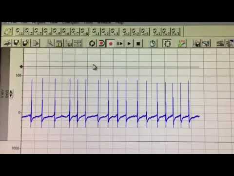 Whole-cell Patch-clamp in brain slices - YouTube