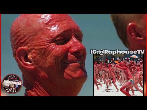 The Sunburn Competition 🌞🔥 This Proves who the “ White man “ is today ...