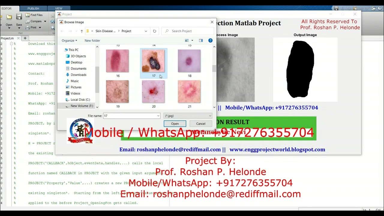 Skin Disease Detection Using Image Processing | With Source Code Matlab Project Skin Disease ...